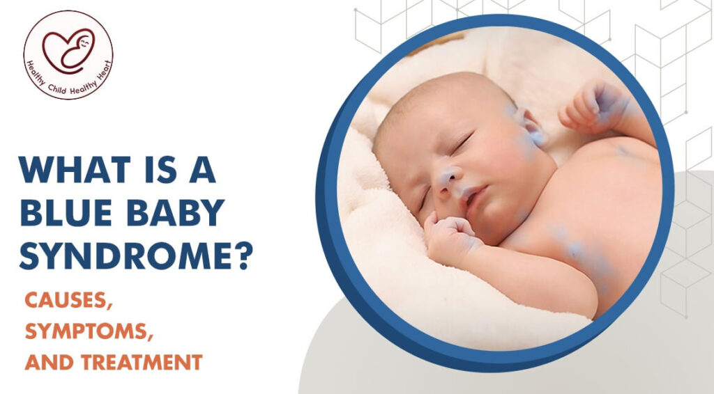 What is a Blue Baby Syndrome? – Causes, Symptoms, and Treatment - Nanhe Dil